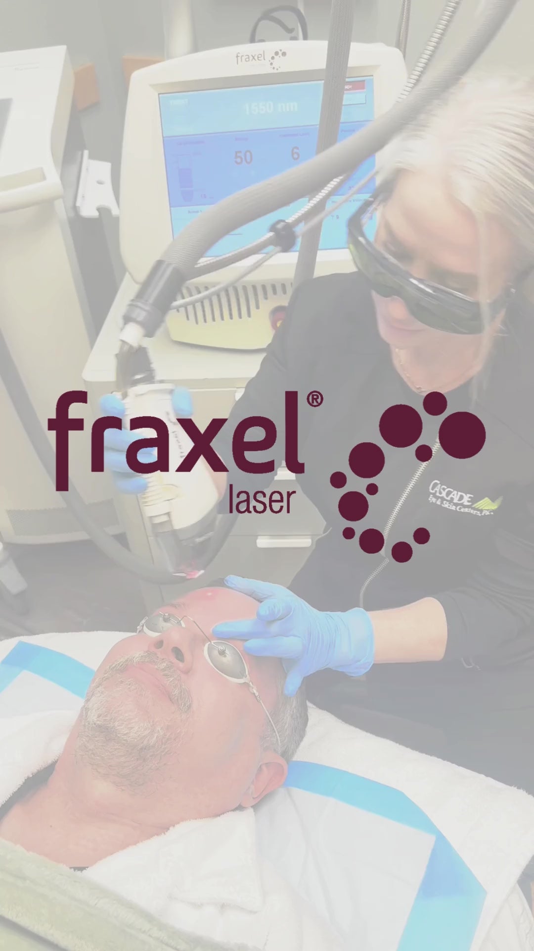 Fraxel Dual Restore & RF Microneedling – Cascade Eye & Skin Centers